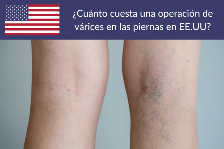 Cuánto Cuesta una Operación de Várices en las Piernas en 2025 - PreciosUSA